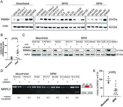 Mpm Cells Express Higher Rbm8a Protein Levels And Are More Sensitive To Download Scientific