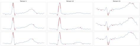 Saliency Maps For Randomly Selected 3 Different Persons From The Ecg Id Download Scientific