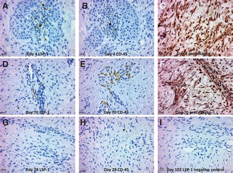 Photomicrographs Of Formalin Fixed Biopsy Specimens At Day 4 A B C Download Scientific