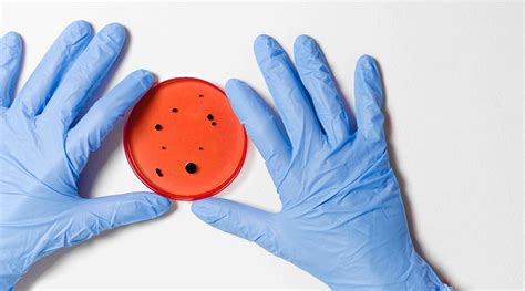 Coliform Bacteria In Water Effects Presence Testing And Precautionary Measures