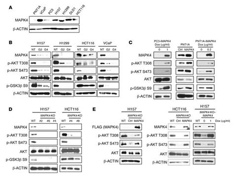 Jci Mapk4 Overexpression Promotes Tumor Progression Via Noncanonical