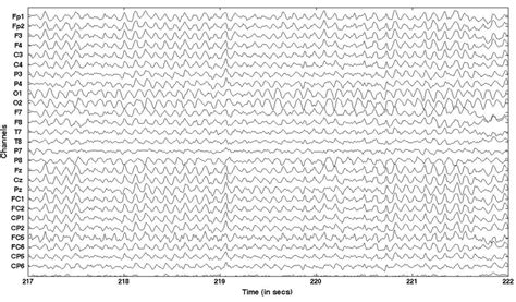 Five Seconds Continuous Resting State Eeg With Alpha Oscillations Download Scientific Diagram