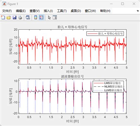 基于Matlab自适应滤波算法的胎儿心电信号提取与分析单输入单输出与多输入单输出系统的对比研究 EW帮帮网