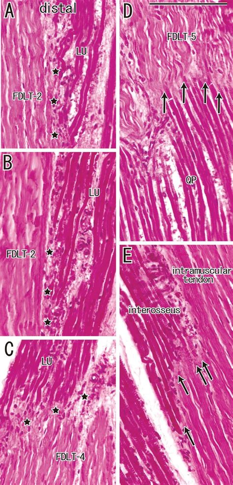 A E Histology Of The Lumbricalis Origin A Difference From Other