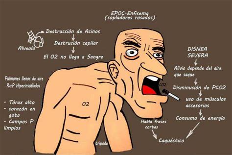 EPOC YUDOC ORG UDocz