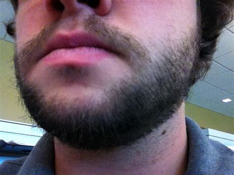 Will Hair Grow Under My Nose Beard Board