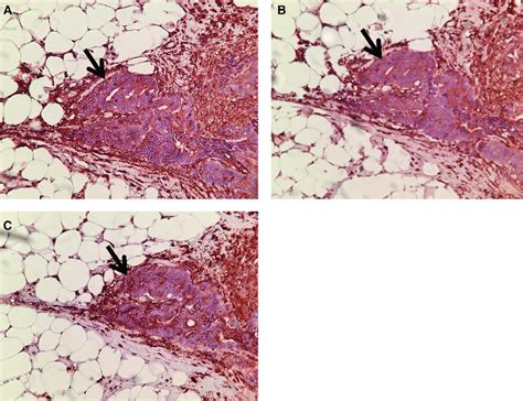 Immunohistochemical Stainings Of Hla Class I A B And Hla Class Ii C Download Scientific