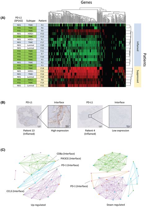 Assayagnostic Spatial Profiling Detects Tumor Microenvironment Signatures New Diagnostic