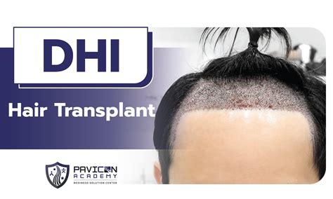 Dhi Hair Transplant Pavicon Mediness Center