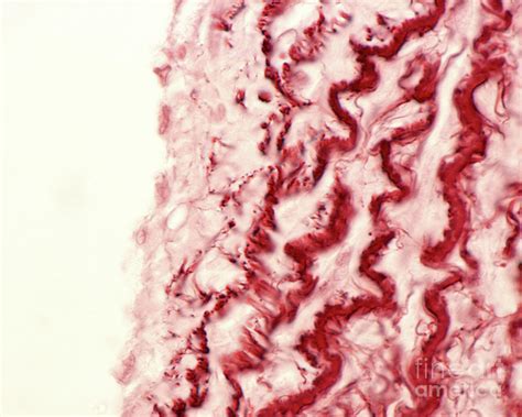 Human Aorta 1 By Science Photo Library