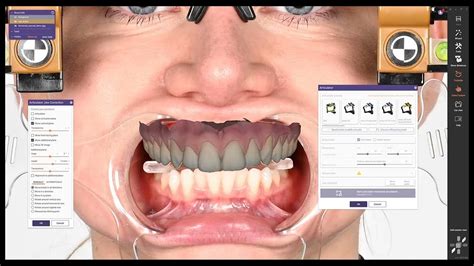 Kois Facial Reference Glasses Kfrg To Kois Digital Transfer Adapter