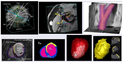 数理医学院袁景教授研究成果入选2022年度中国医学人工智能代表性算法