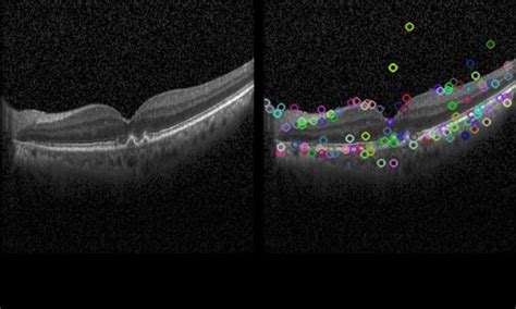 4 A Input Image And The Sift Feature Of B 5x5 Kernel Download