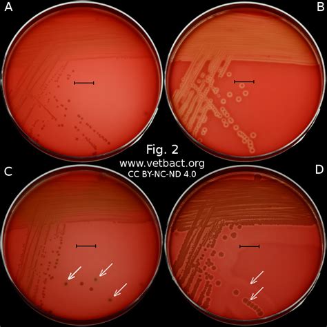 Specimen Exhibits Hemolysis At Amanda Litherland Blog