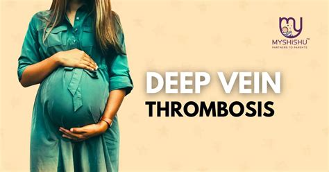Dvt During Pregnancy A Comprehensive Guide Myshishu