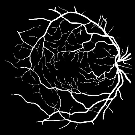 Retina Vessel Segmentation Instance Segmentation Dataset By Jp