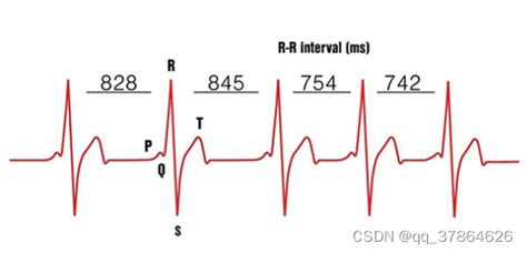 Python Neurokit2 生理信号的区间相关分析（interval Related Analysis） Csdn博客