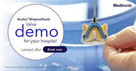 Medtronic Cardiac And Vascular On Linkedin Health Tech For The Digital Age