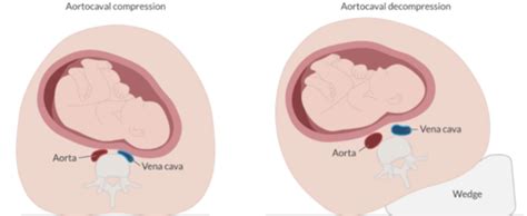 Apex Anesthesia Unit Across The Lifespan Flashcards Quizlet