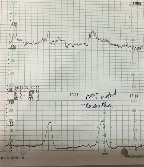 Journal Of Postgraduate Gynecology And Obstetrics Interpretation Of An
