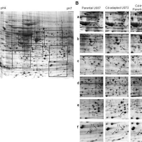 Comparison Of The Two Dimensional Protein Expression Pattern Of Download Scientific Diagram