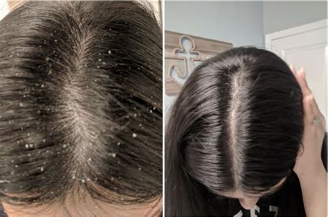 43 Click To Reveal Beauty Product Before After Photos