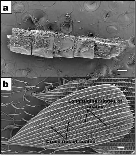 Scanning Electron Microscopic View Of Abdomen Of An Subpictus A
