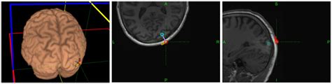 Successful Experiment To Send Messages Directly To The Brain Via The