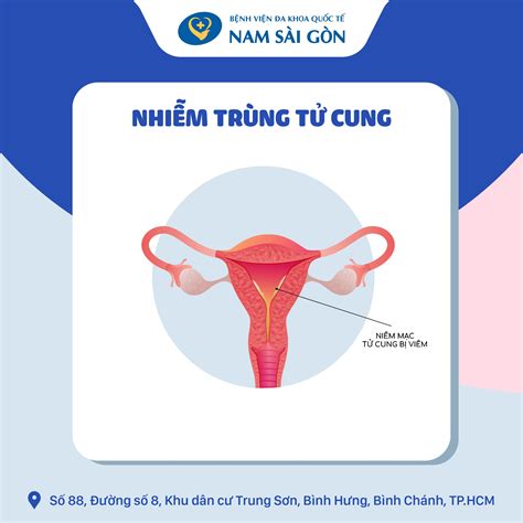 Những Vấn đề Phụ Khoa Thường Gặp ở Phụ Nữ Sau Sinh