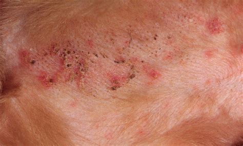 Recurrent Pyoderma In A Golden Retriever