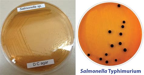 Deoxycholate Citrate Agar Dca Composition Principle Preparation Results Uses
