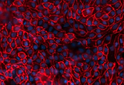 In Vitro Models For Predicting Human Renal Toxicity