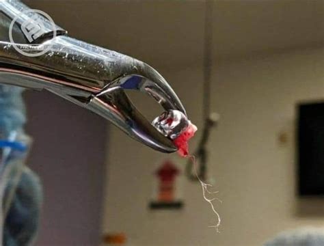 رشته های عصبی دندان 😬 تمام درد دختر دهاتی Country Girl