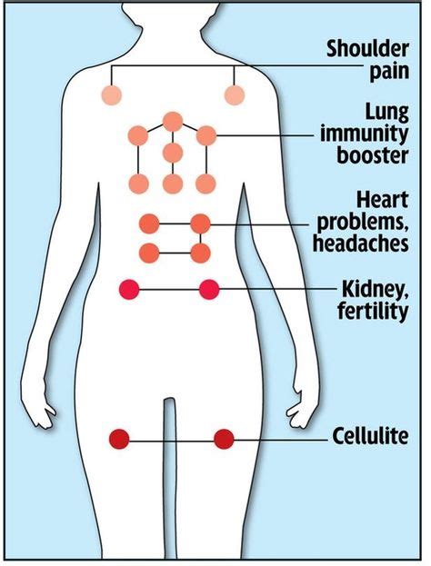 17 Cupping Ideas Cupping Therapy Massage Therapy Trigger Points