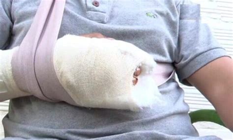 Padrastro Machetea A Su Hijastro Por Despertarlo Accidentalmente Prensa