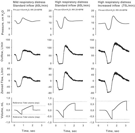 Exemplary Plots Of Pressure Within The Helmet First Row And Recorded Download Scientific