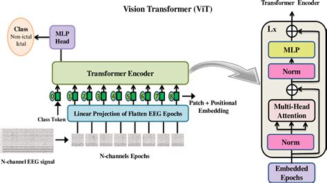 Lightweight Convolution Transformer For Cross Patient Seizure Detection