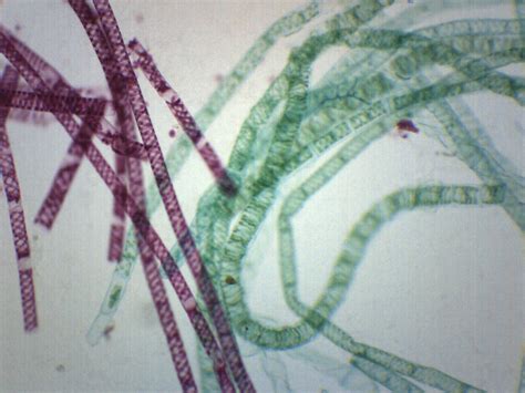 Spirogyra Microscope Slide Labeled
