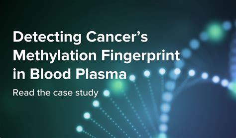 Kristi Kruusmaa Posted On Linkedin