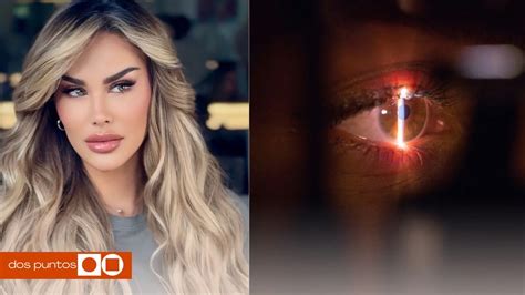 Ninel Conde Ojos ¿se Hizo Una Operación Dospuntos Media