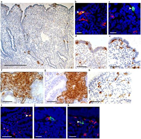 Distribution Of Antigen Presenting Cell Subsets In Human Endometrium