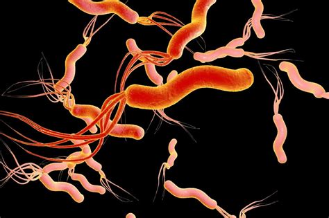 High Dose Dual Therapy Vs Bismuth Quadruple Therapy For Helicobacter
