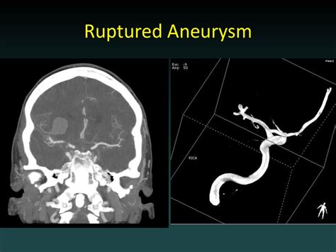 Introductory Neuroimaging What You Need To Know At 3 Am And Some Cool Stuff Online Presentation