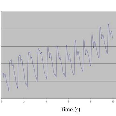Measurement Scheme With The Network Analyzer And The Antenna A Time Download Scientific
