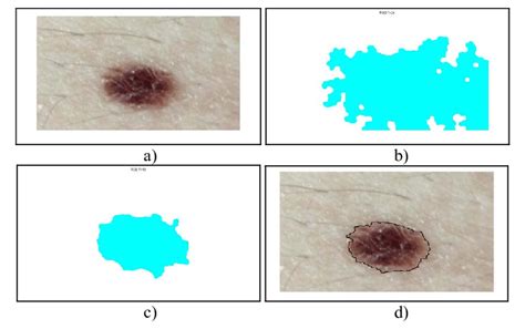 Segmentation Results For Rgb Color Space Representation A Original Download Scientific
