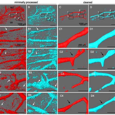 No Induced Focal Dilation Of Outflow Tract Vessels Download