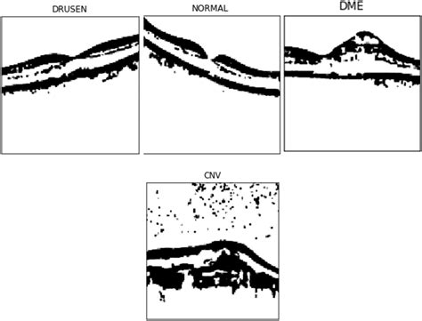 Segmented Retinal Structure Results Download Scientific Diagram Segmented Retinal Structure Results Download Scientific Diagram