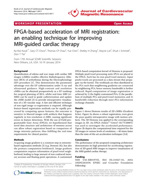 Fpga Based Acceleration Of Mri Registration An Enabling Technique For