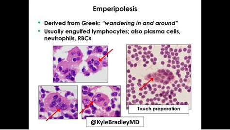 Exams And Me Emperipolesis