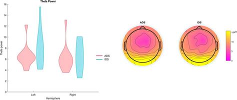 Results Of The Eeg Power Analysis Averaged For All Epochs Recorded In